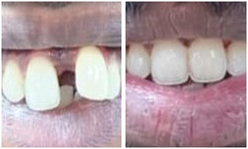 Dentino Oral Experts - Advanced Dental Clinic